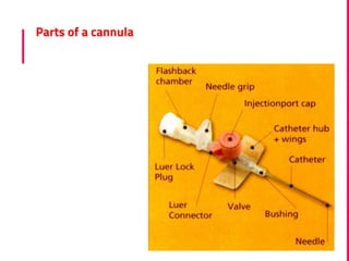 Safe iv cannulation (prevention of iv thrombophlebitis) | PDF