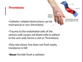 Safe iv cannulation (prevention of iv thrombophlebitis) | PPT