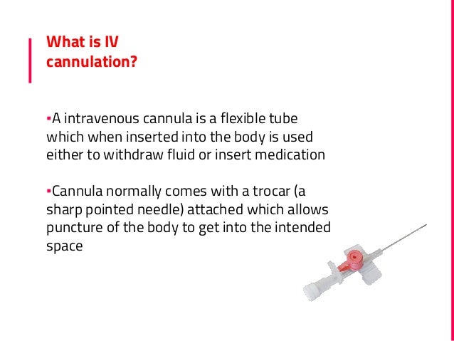 Safe iv cannulation (prevention of iv thrombophlebitis)