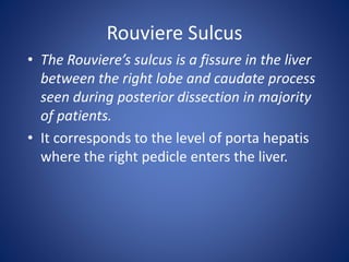Safe laparoscopic cholecystectomy finale | PPT