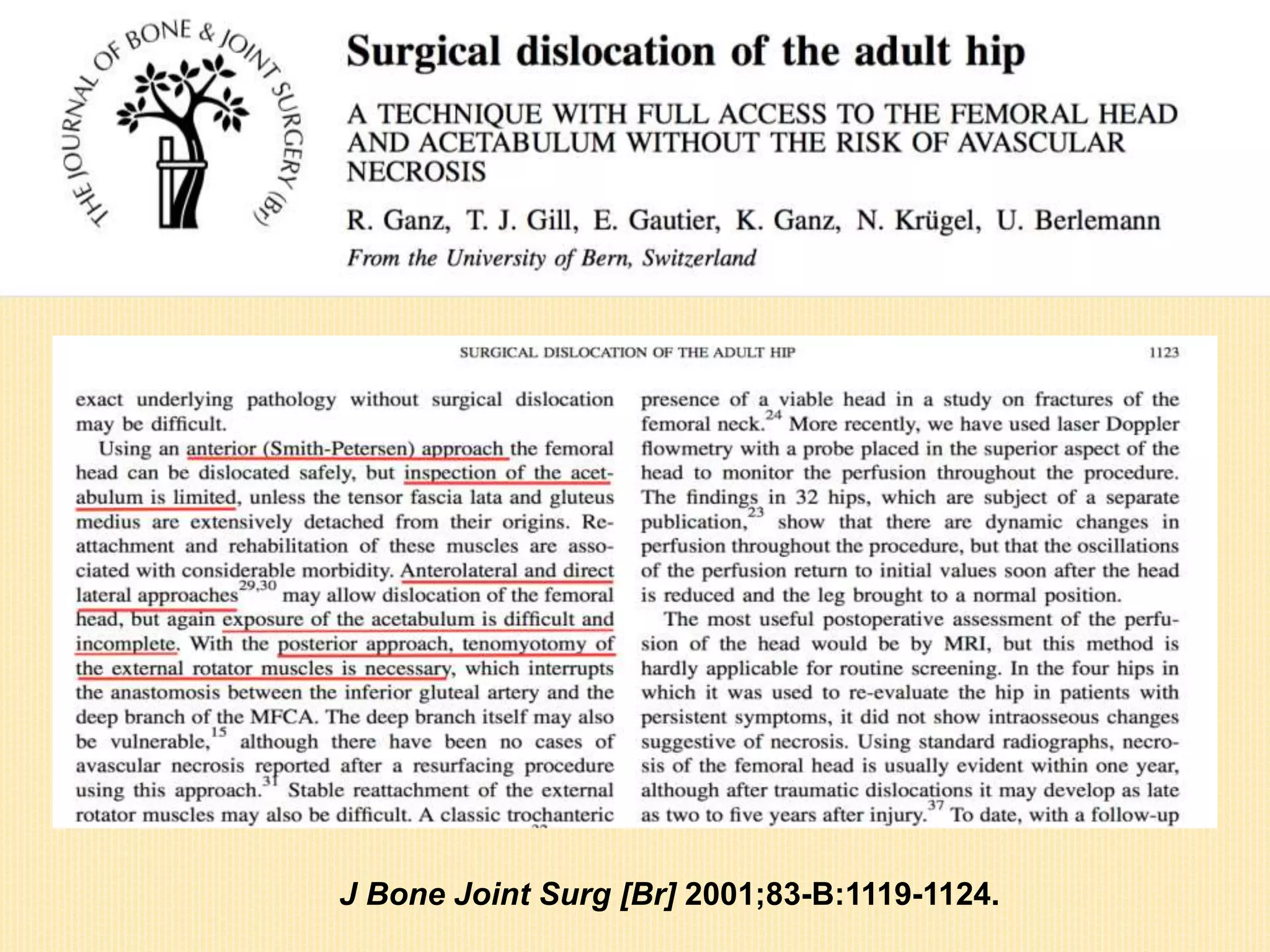 Safe Surgical Dislocation For Femoral Head Fracturesdr Mohamed Ashraf 8942