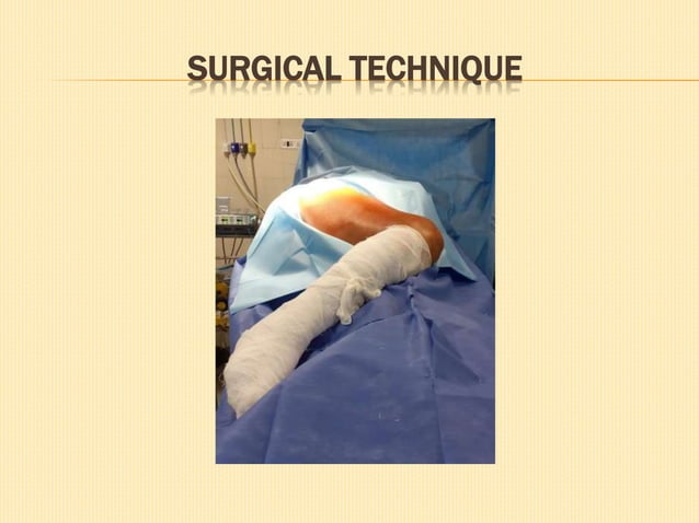 Safe surgical dislocation for femoral head fractures.dr mohamed ashraf ...