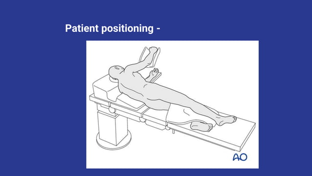 Safe Surgical Dislocation of Hip Joint.pptx | Death, Injury, or ...