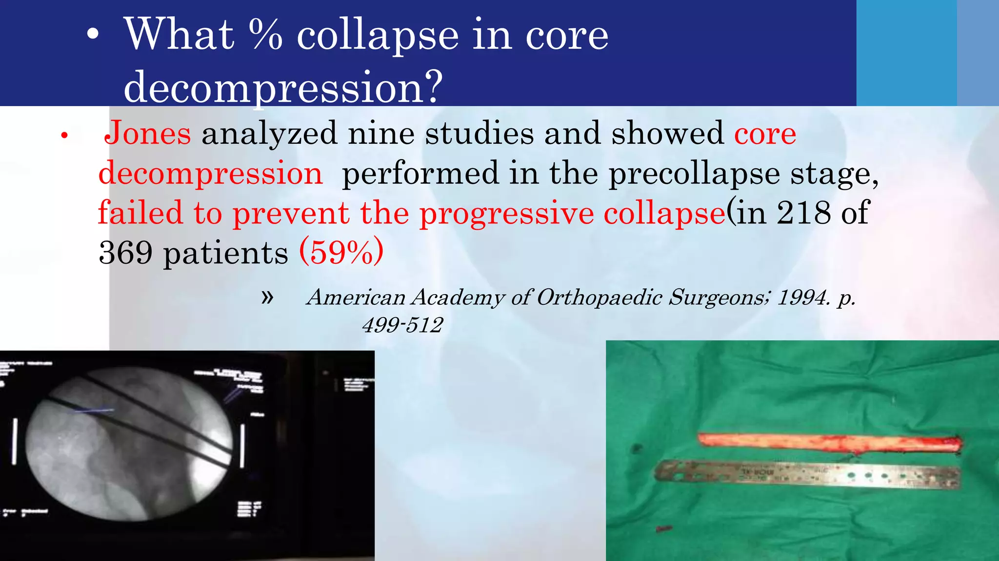 Safe surgical dislocation[ssd] for avascular necrosis hip[ avn] | PPTX