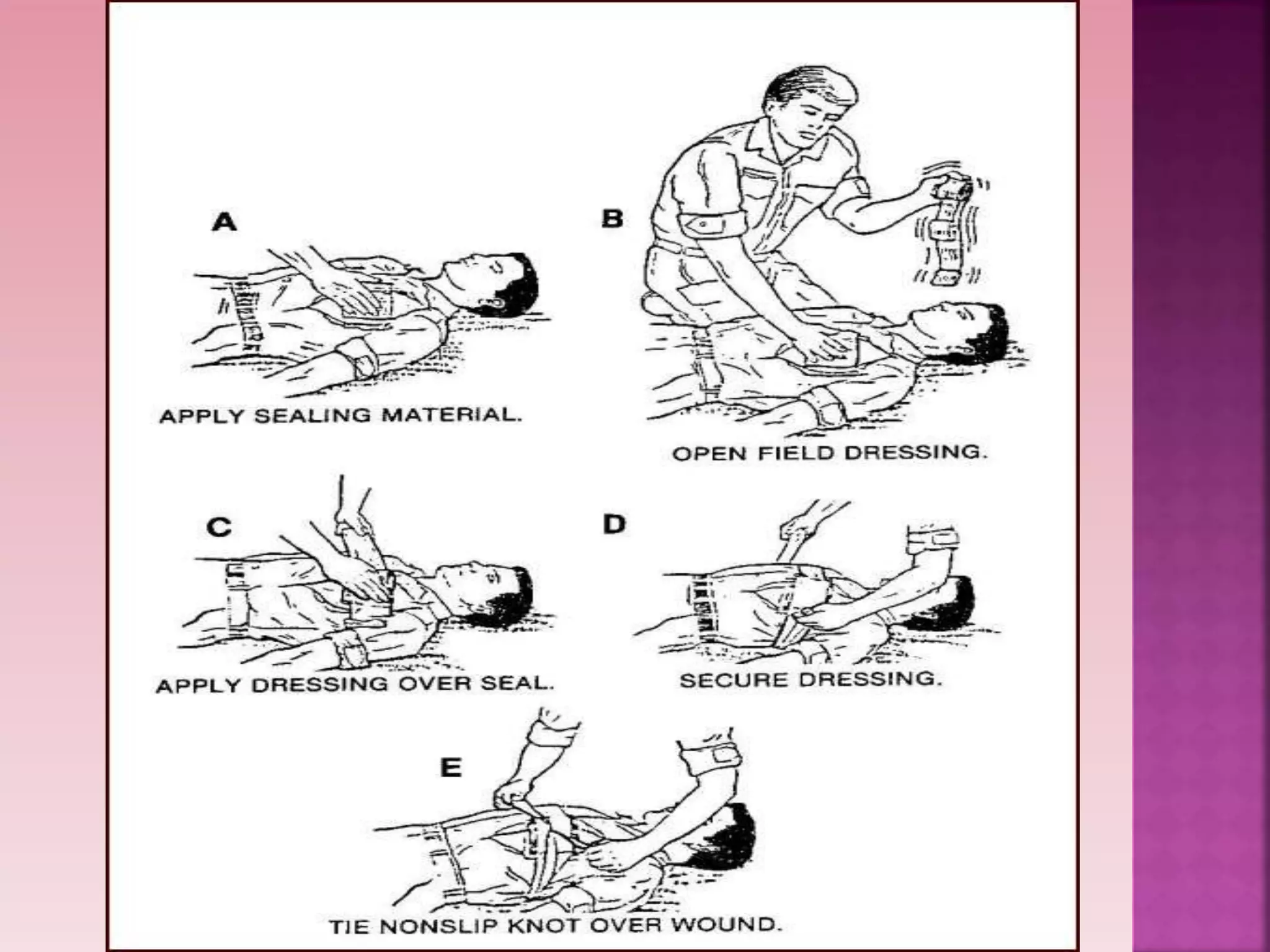 SAFTY AND FIRST AID | PPT