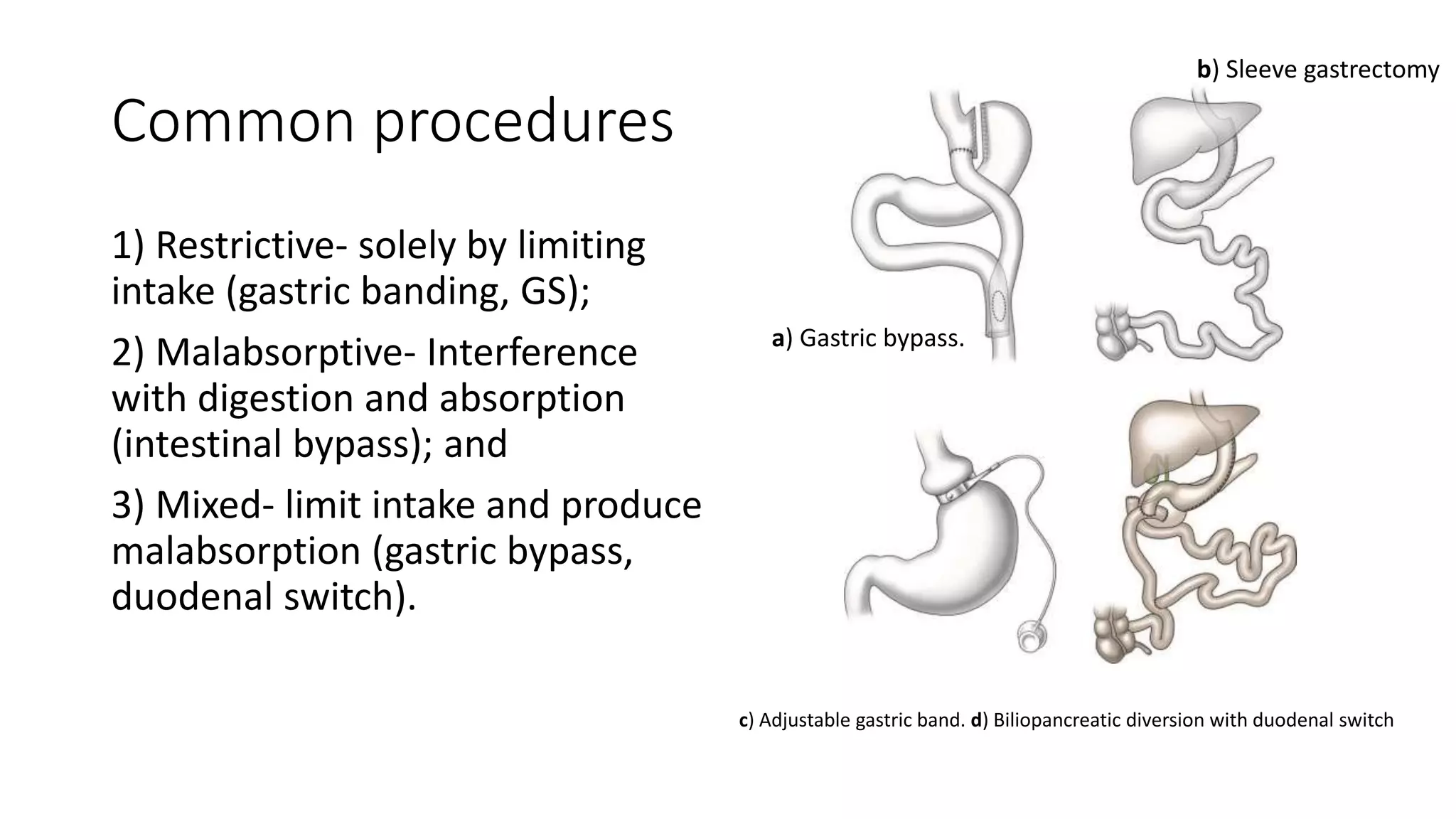 Safety in bariatric surgery.pptx