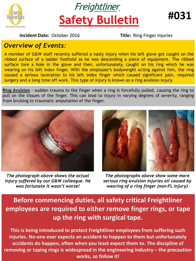 Safety bulletin 031 ring finger injuries | PDF
