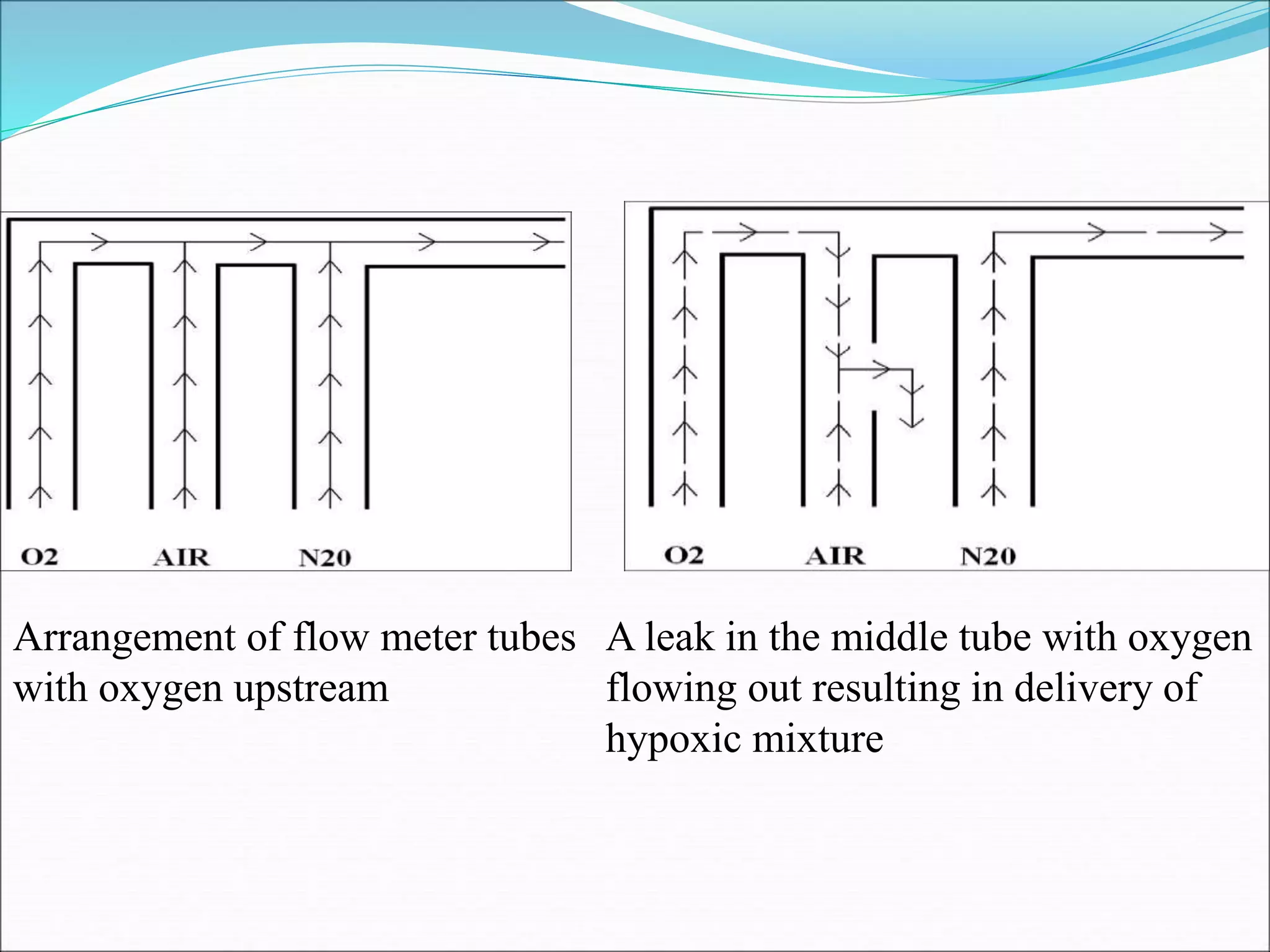 Safety feature of BOYLE'S anesthesia machine | PPT