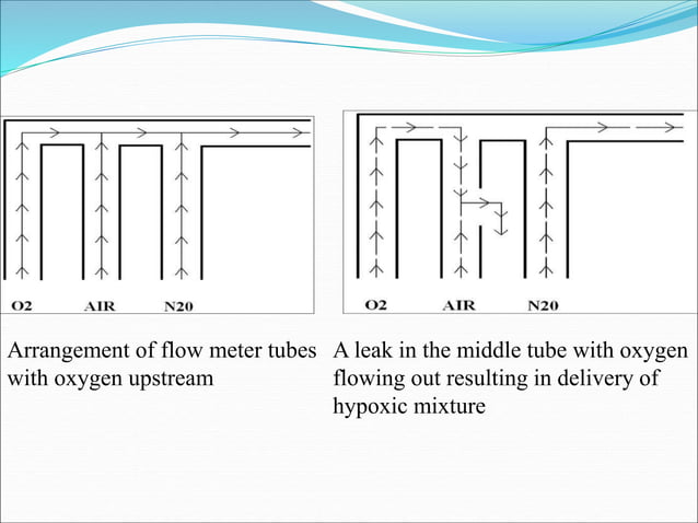 Safety feature of BOYLE'S anesthesia machine | PPT