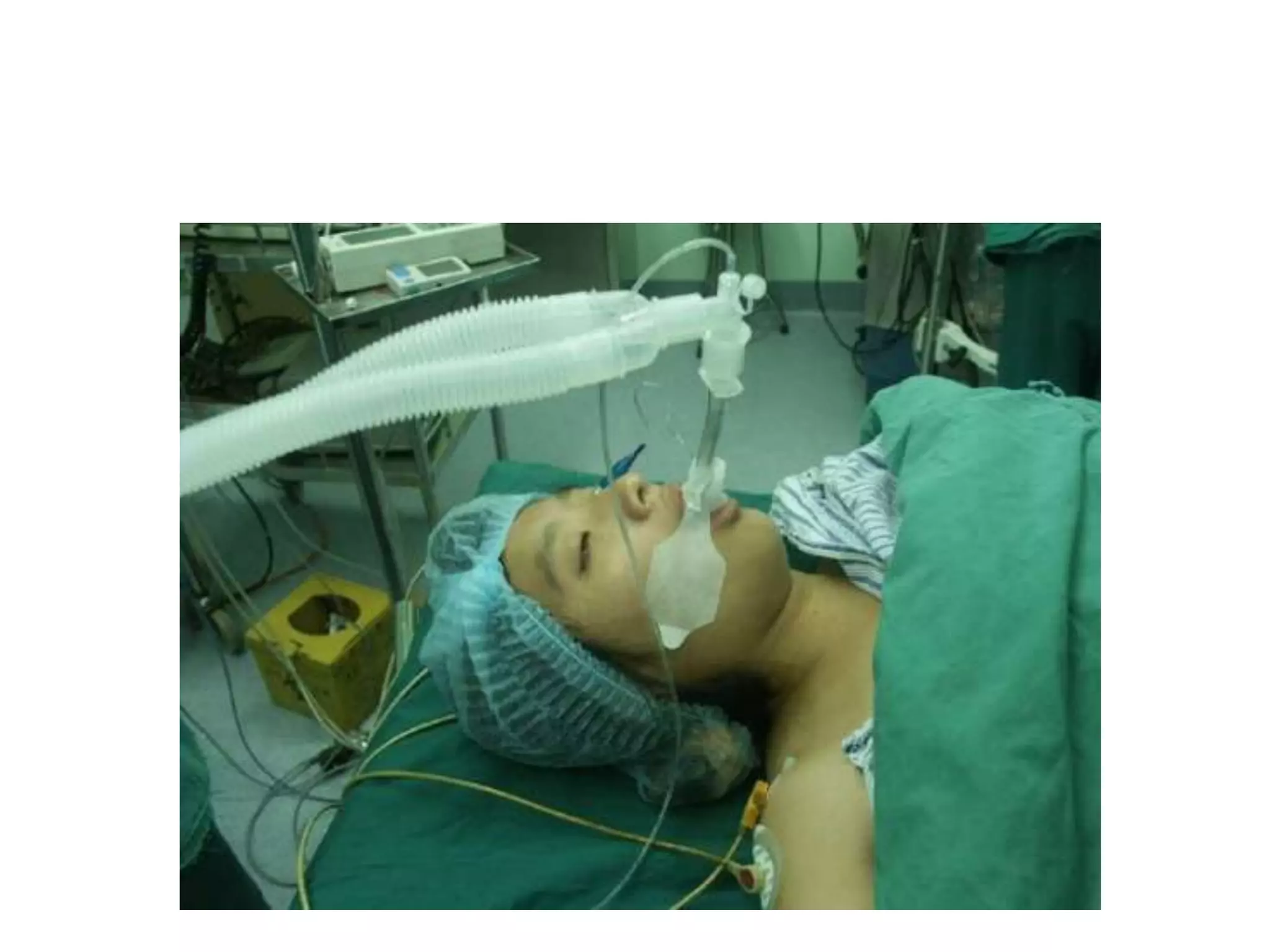 Safety in Anesthesia | PPTX