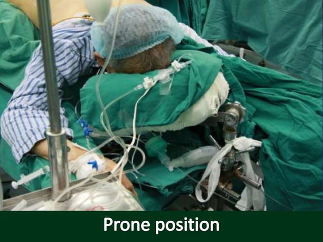 Safety in Anesthesia | PPTX