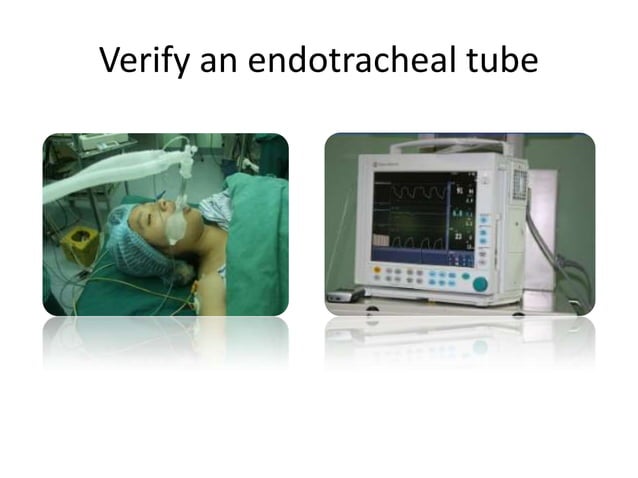 Safety in Anesthesia | PPTX