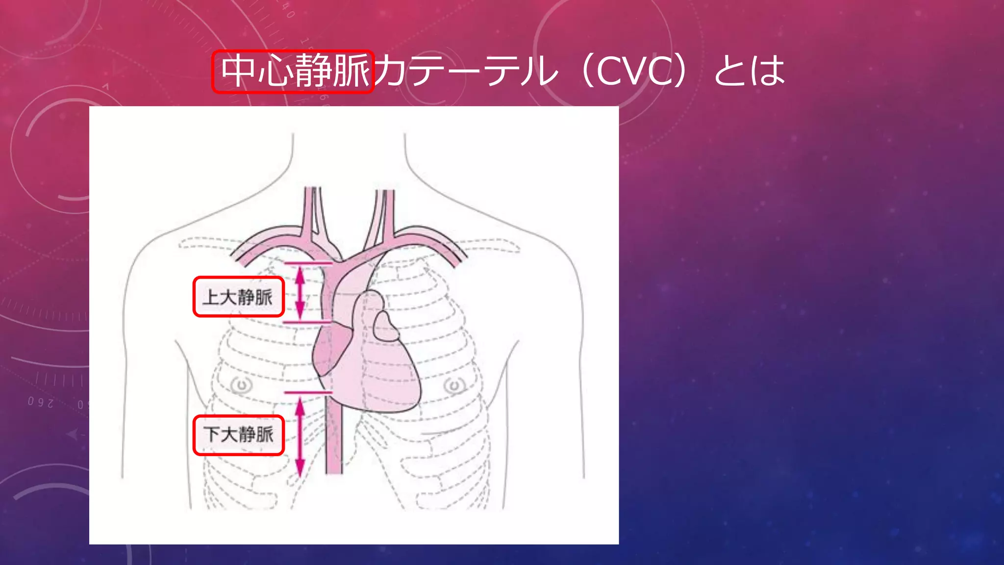 Safety management for cvc insertion | PDF