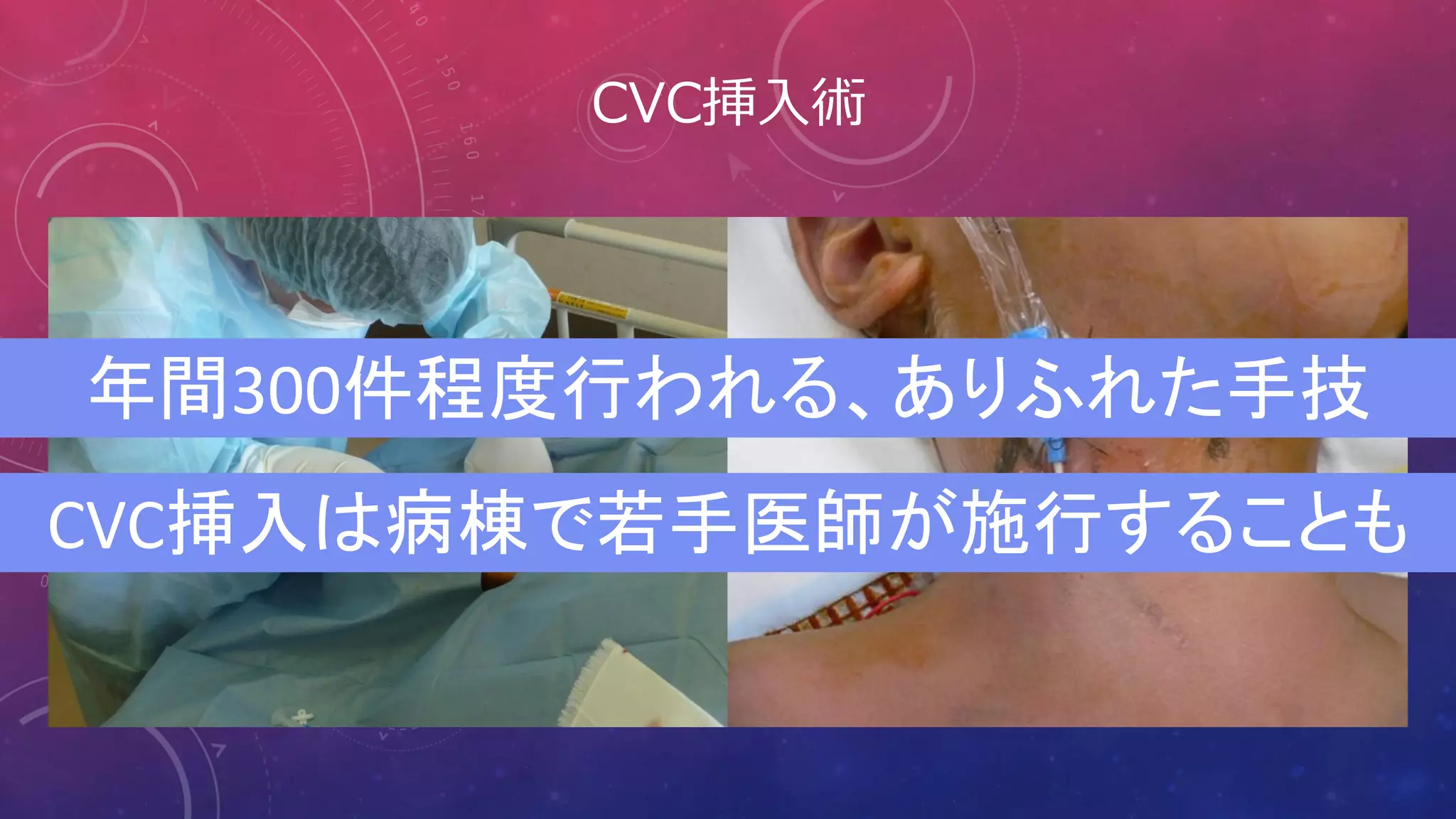 Safety management for cvc insertion | PDF