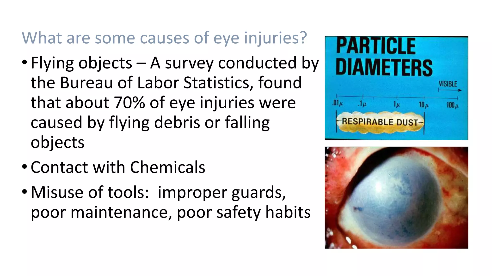 Safety measures to prevent ocular injuries | PPTX