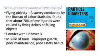 Safety measures to prevent ocular injuries | PPTX