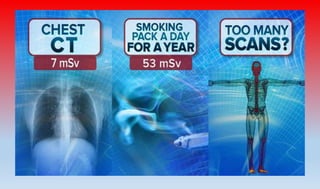 Safety of ct scan. | PDF