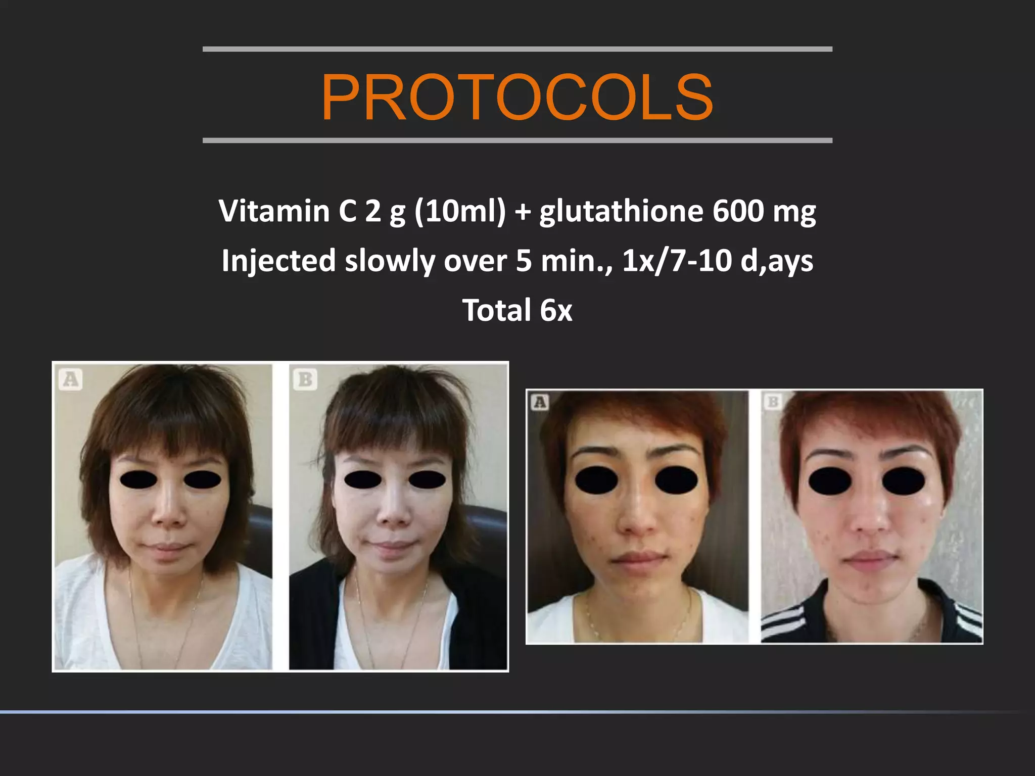 Safety protocol in vitamin c injection | PPTX | Blood Disorders ...