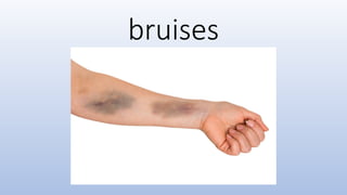 Safety Safety Safety Safety Safety Safety Safety Safety Vocabs lesson ...