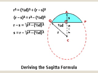 Sag formula | PPTX