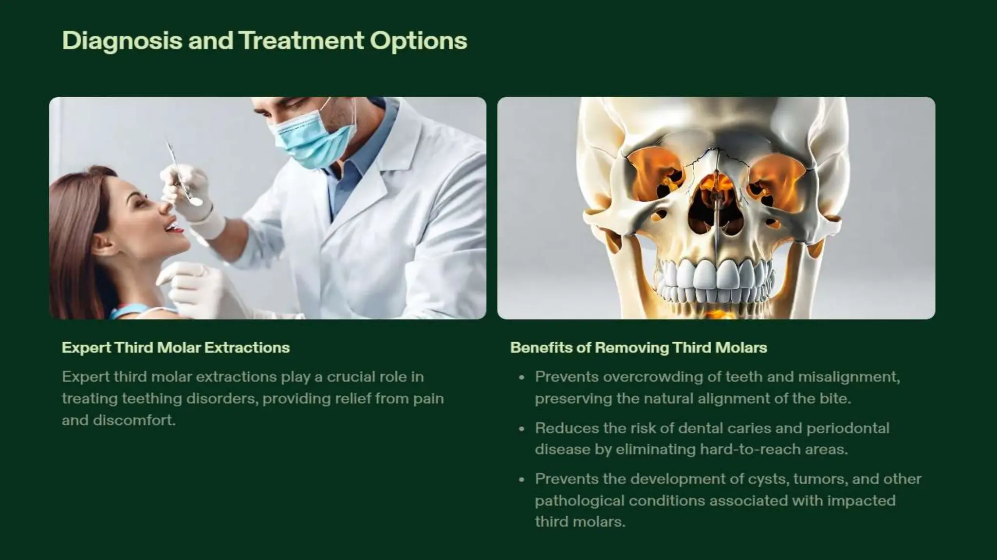 teething disorders and expert third molar extraction | PPT