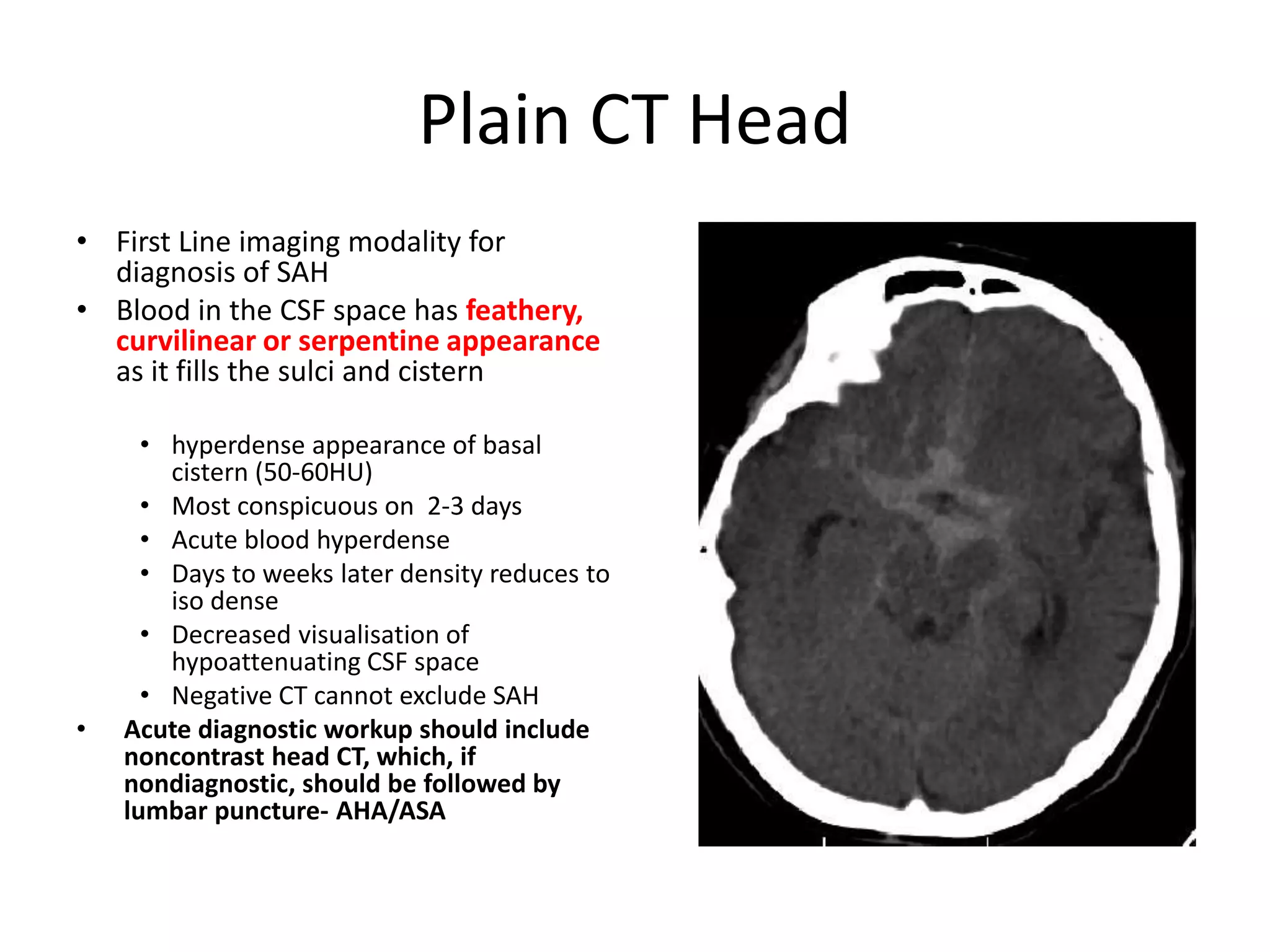 Non traumatic Subarachnoid hemorrhage (SAH) | PPTX