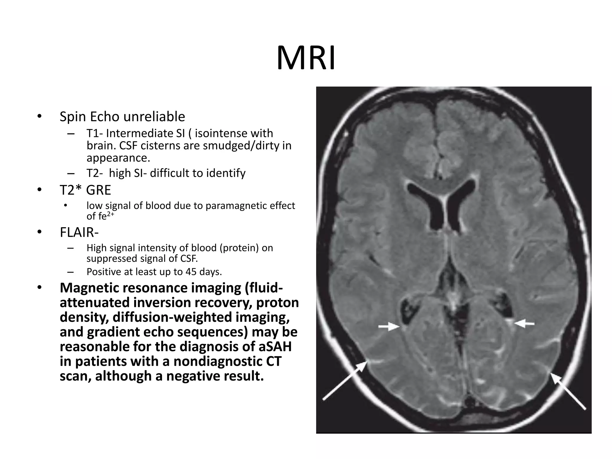 Non traumatic Subarachnoid hemorrhage (SAH) | PPTX