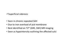Subarachnoid hemorrhage in brain. .pptx