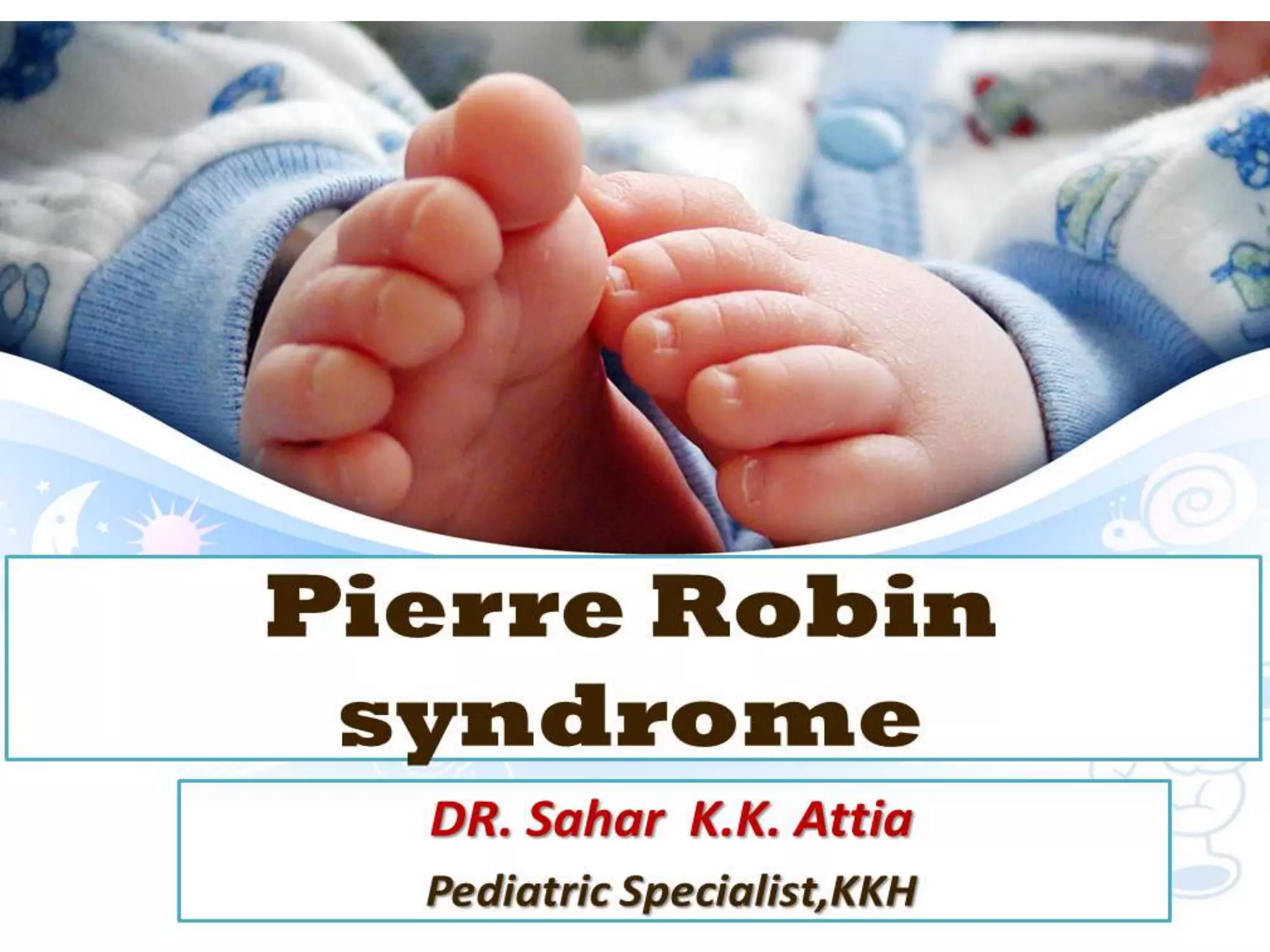 Pierre Robin Syndrome | PPTX | Ear, Nose and Throat Conditions ...