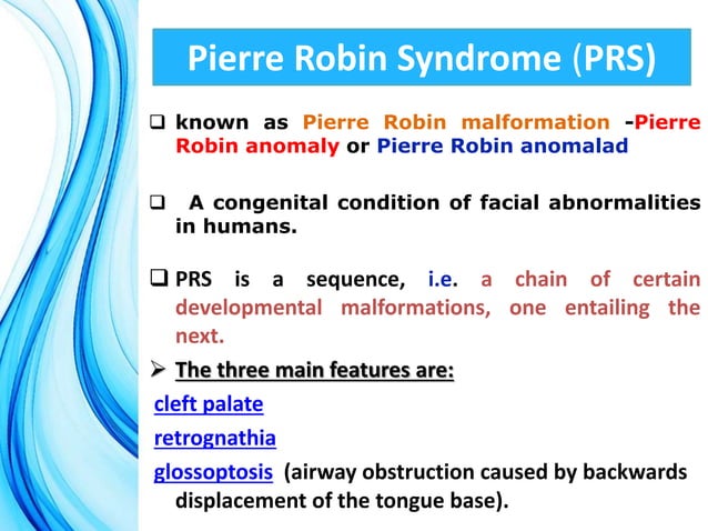 Pierre Robin Syndrome
