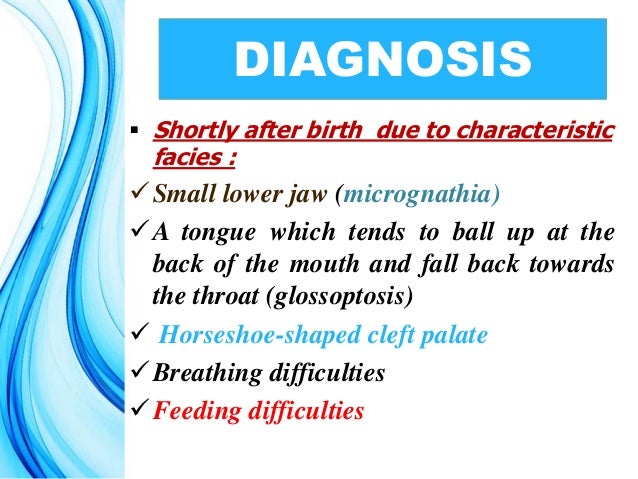 Pierre Robin Syndrome