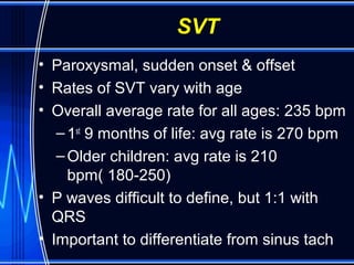 PEDIATRIC DYSRHYTHMIA 2015 | PPT