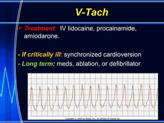 PEDIATRIC DYSRHYTHMIA 2015 | PPT