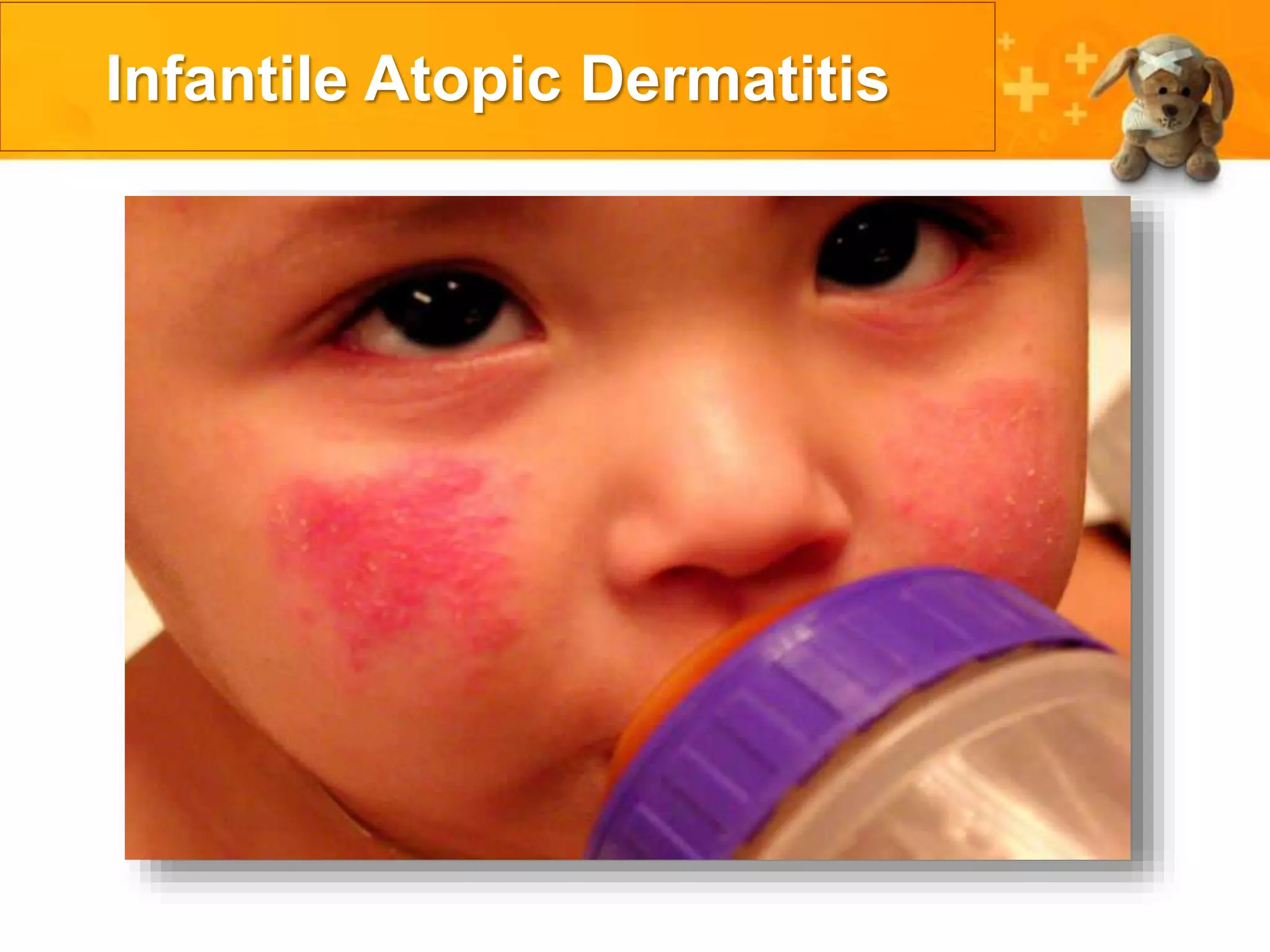 Common pediatric skin rash | PPTX | Infectious Diseases | Diseases and ...