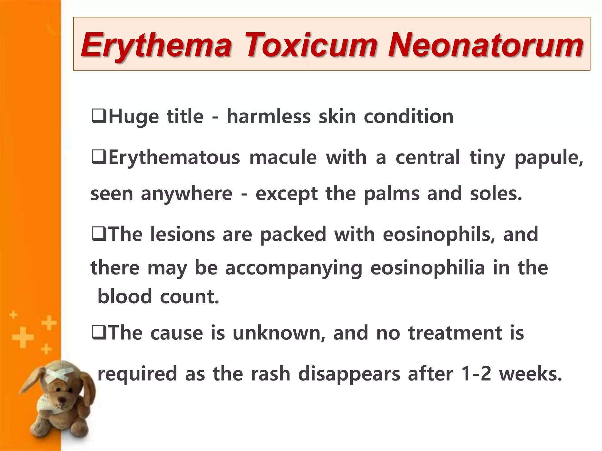 Common pediatric skin rash | PPTX