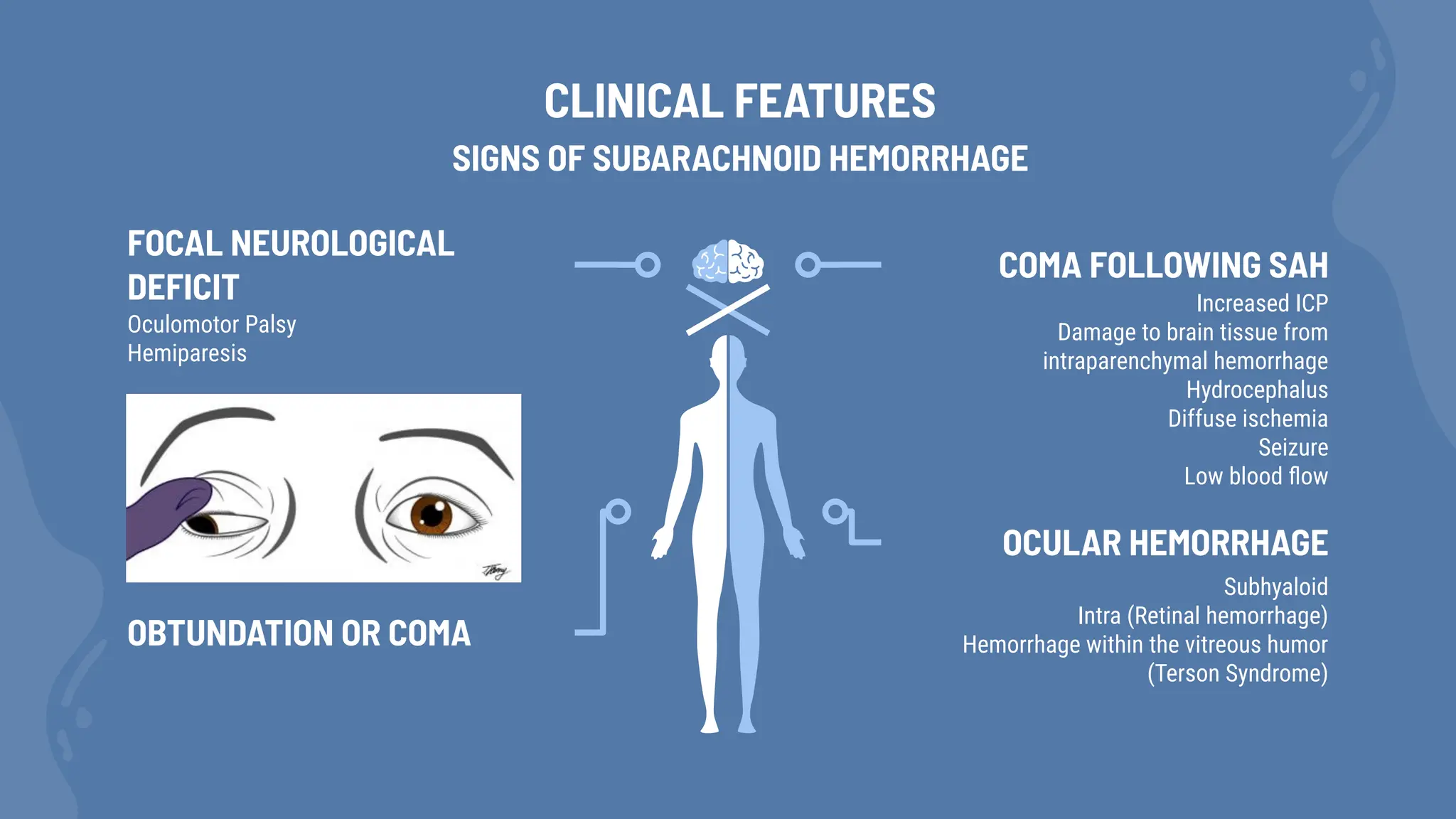 Lecture on Subarachnoid Hemorrhage (Surgery) | PDF
