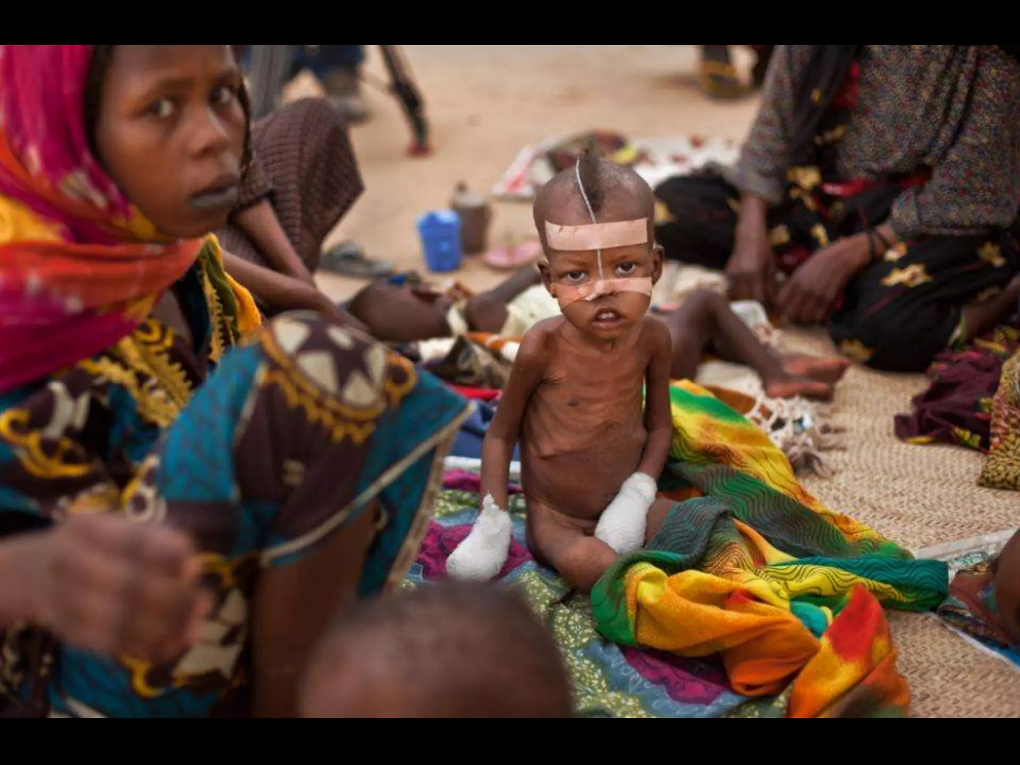 Sahel region food crisis | PPS