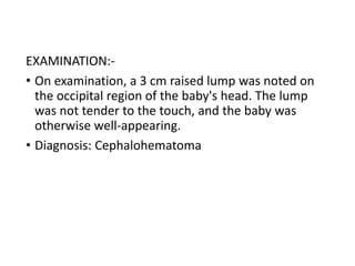 Cephalhaematoma Case Study.pptx