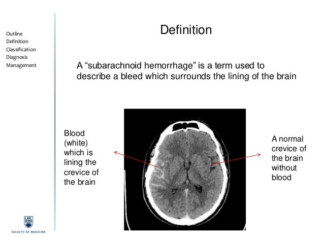 Sah info for patient's families