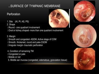 Tympanic Membrane Exam Slidesho