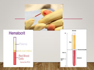 Sahli+pcv practical hemoglobinometer and hematocrite | PPTX