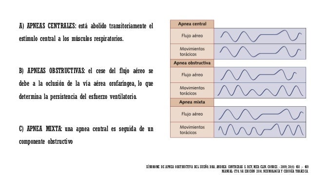 Síndrome de Apnea Hipopnea obstructiva del Sueño Dr. Barramuño