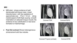 Sposter presentation radio diagnosis msk | PPTX