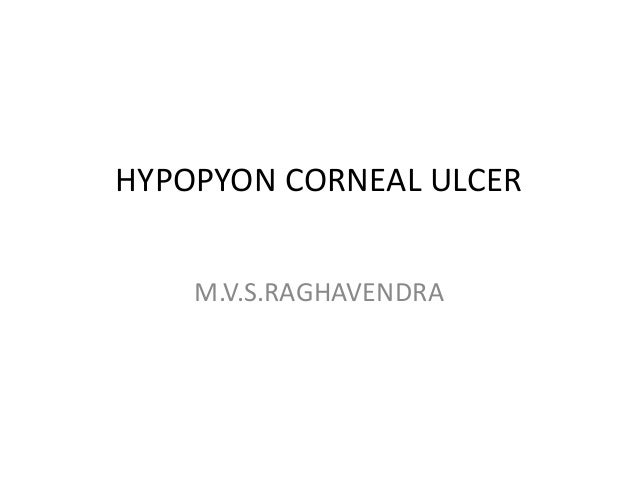 Hypopyon Corneal Ulcer