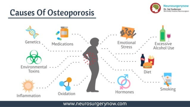 Osteoporosis Treatment in Hyderabad | Best Neurologist in India