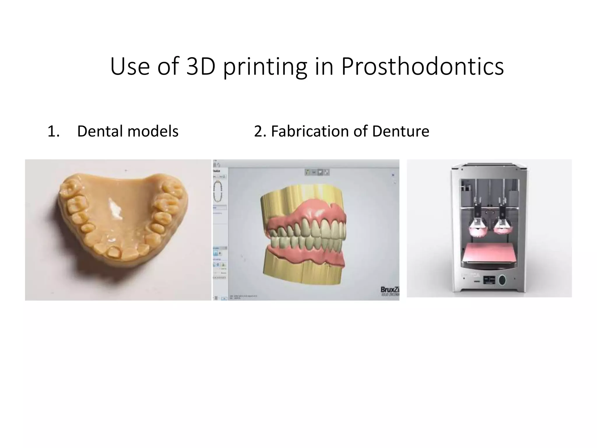 3d printing in prosthodontics K V G | PPTX
