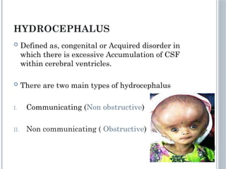 CAse presentation on pediatric hydrocephalus | PPTX