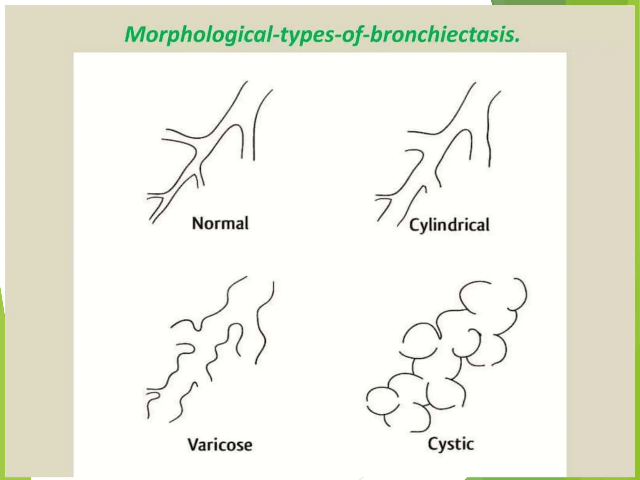 Diagnosis and Imaging of Bronchiectasis.ppt