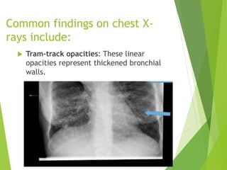 Diagnosis and Imaging of Bronchiectasis.ppt