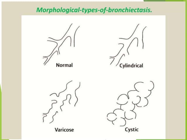 Diagnosis and Imaging of Bronchiectasis.ppt | Lung and Respiratory ...
